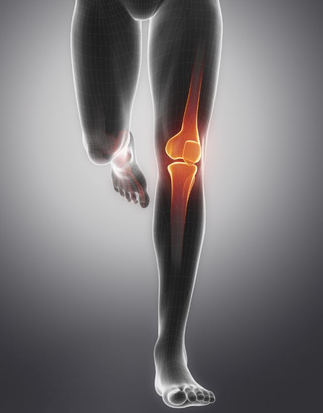 Patellaspitzensyndrom - Ursachen | Symptome | Behandlungen